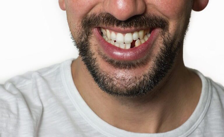 Biblical Insights: Understanding the Meaning of Teeth Falling Out ...