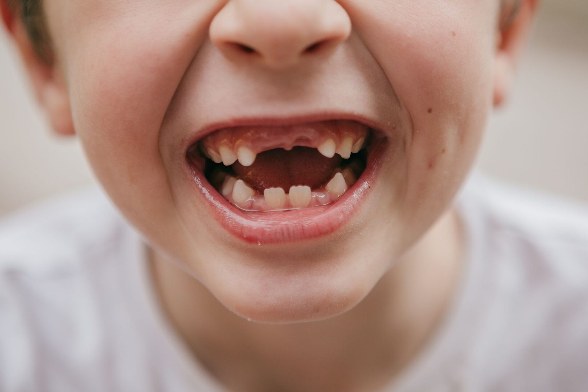 The Biblical Significance of Teeth Falling Out in Dreams - John Baptist ...